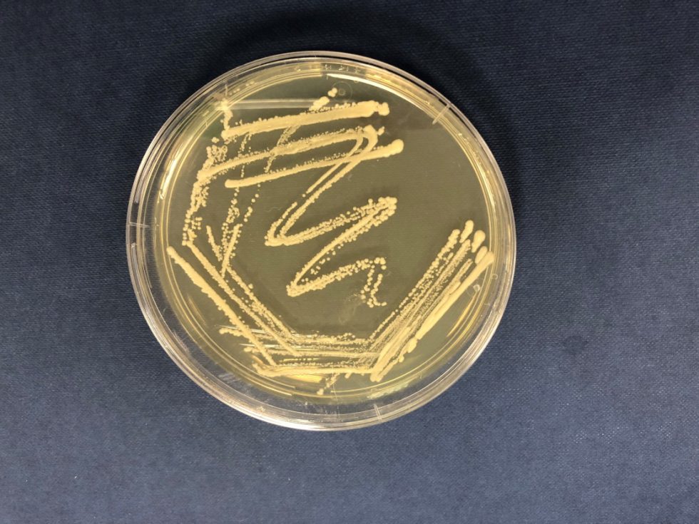 Could yeast and bacteria replace fossil fuels? - Futurum
