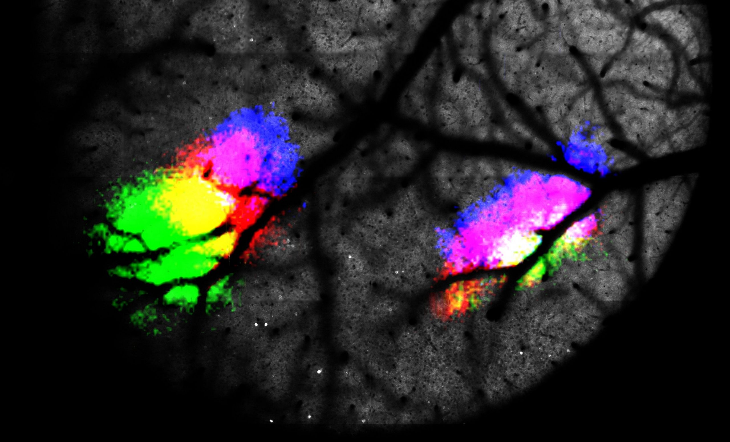 Can we control the electrical activity in our brains? - Futurum