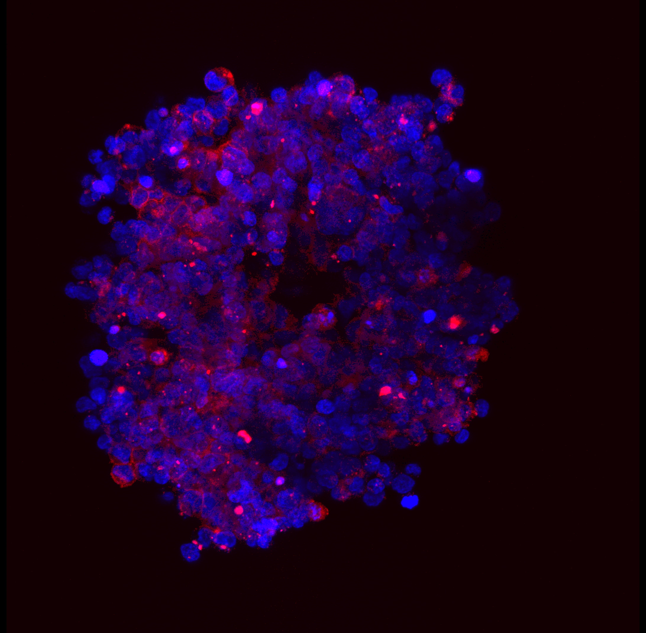 Lighting up cancer: innovation in paediatric surgery - Futurum