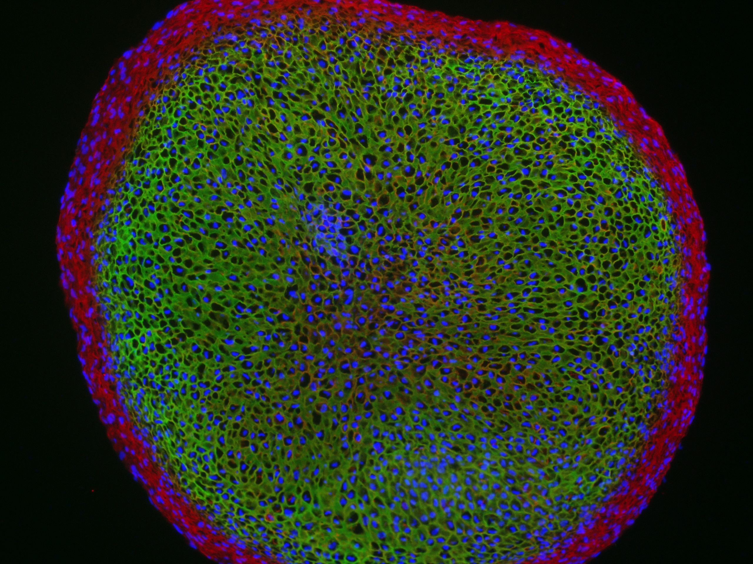Knees, noses and NASA: how can microgravity help us study and test ...