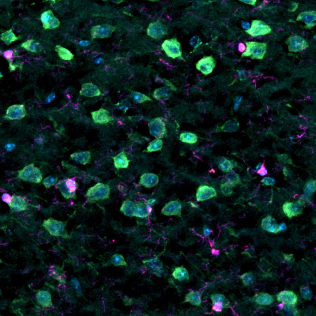 Could the brain’s over-eager ‘pruning shears’ be causing schizophrenia ...